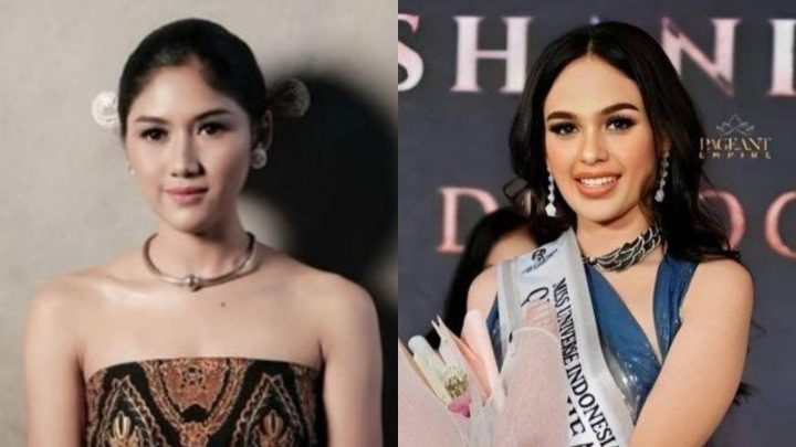 Shania Hamdun Benarkan Erina Gudono Bau Ketek, Sakit Hati Pernah ...